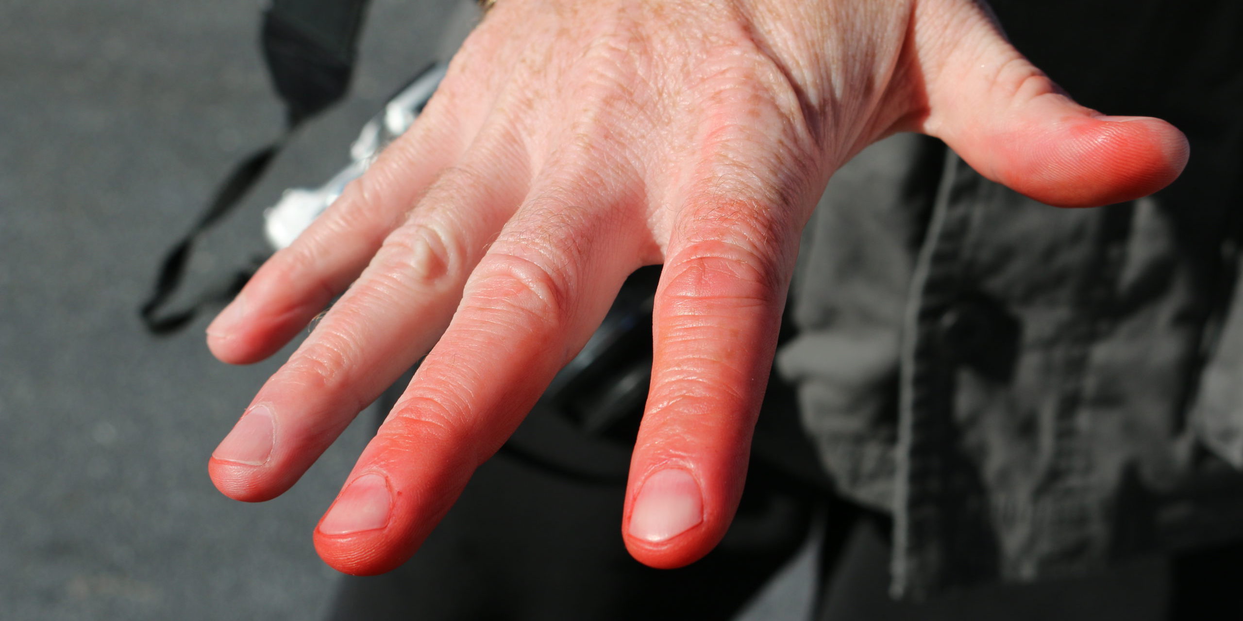 Frostbite 101: An RV Winter Survival Guide - RV Trader Blog